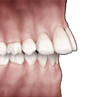 Dr Guillaume Munier - Orthodontie Chaumont